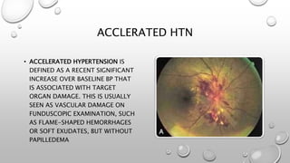 Diagnosis of hypertension | PPTX