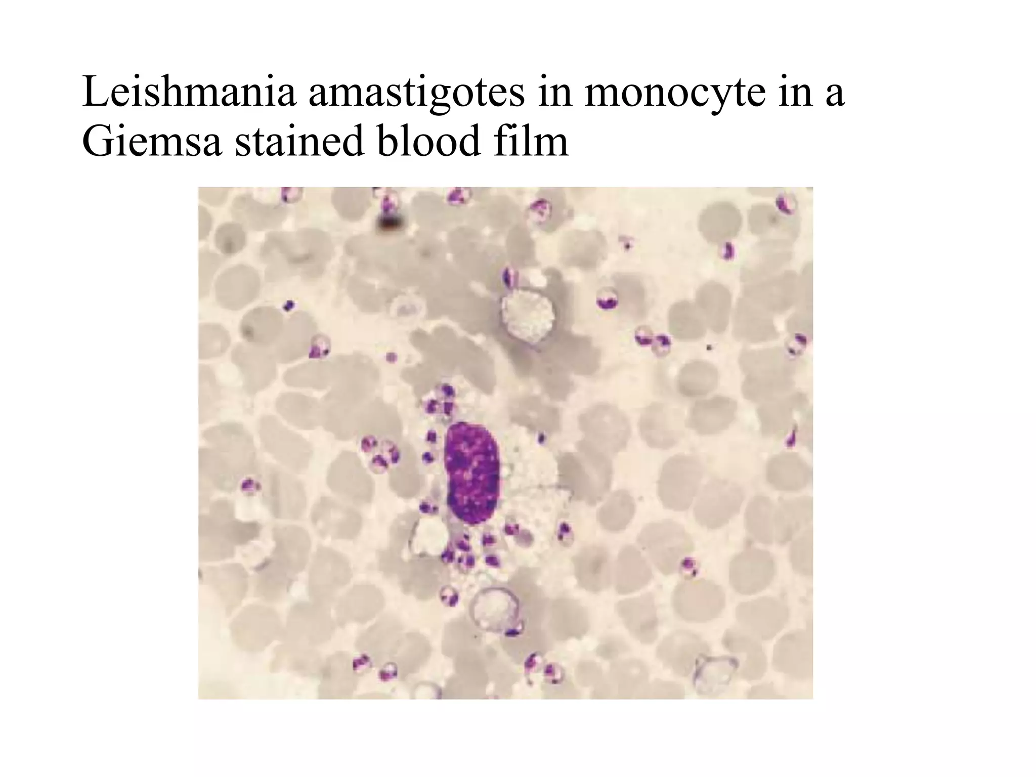 Diagnosis of leishmania parasite | PPSX