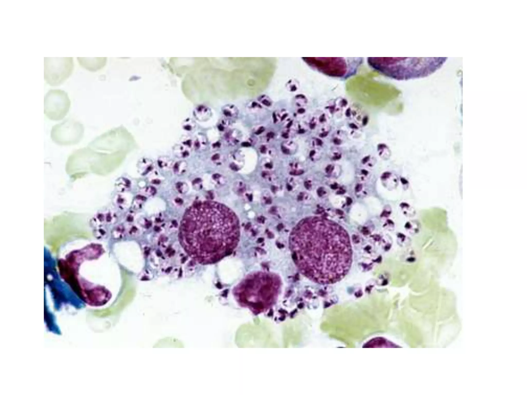 Diagnosis of leishmania parasite | PPSX