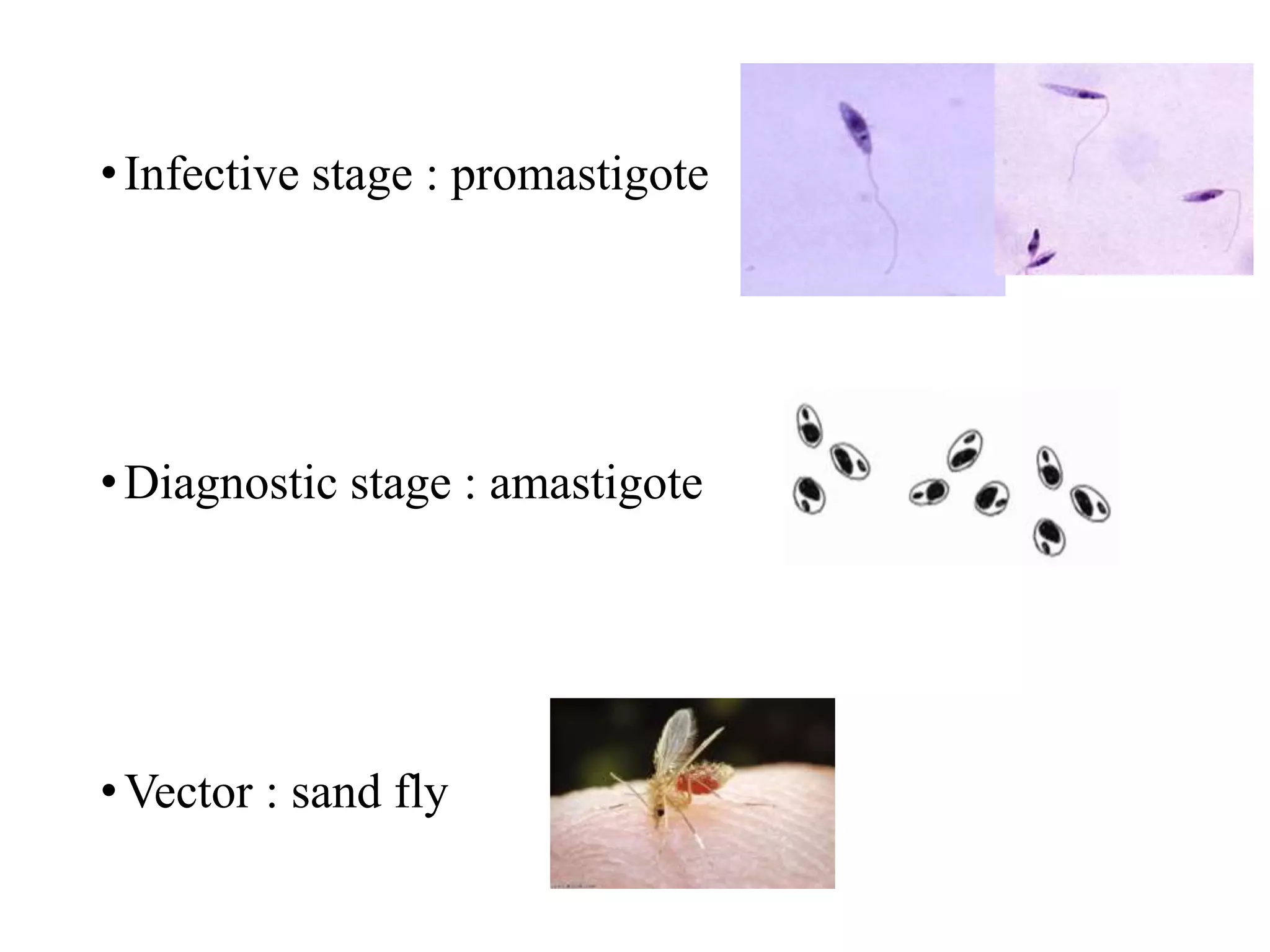 Diagnosis of leishmania parasite | PPSX