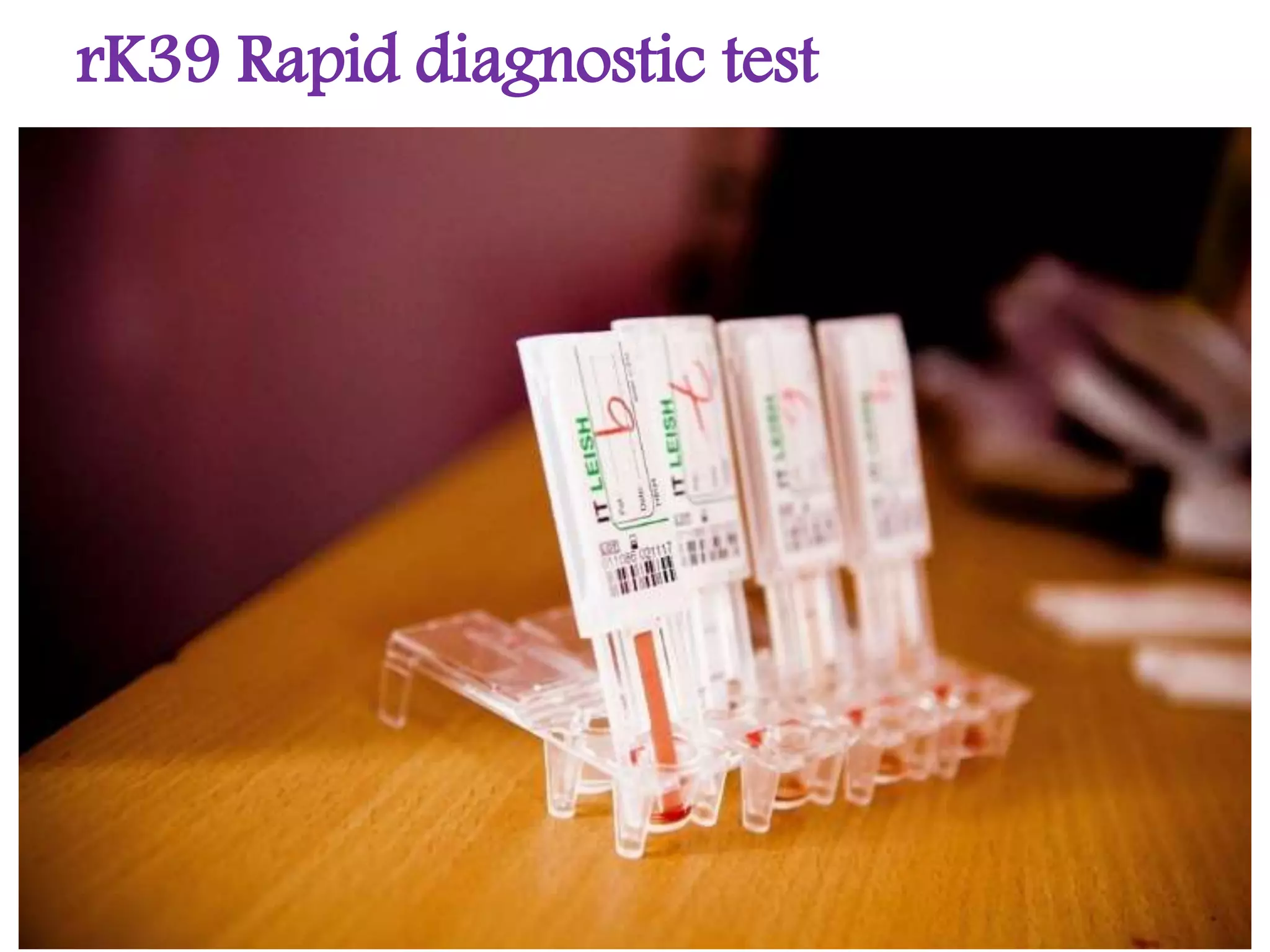 Diagnosis of leishmania parasite | PPSX