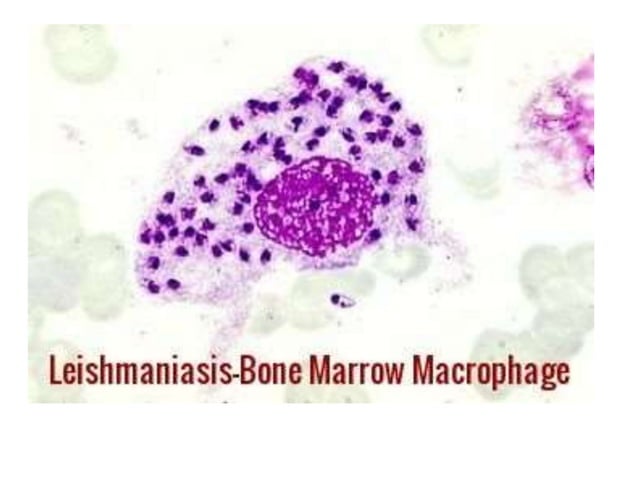 Diagnosis of leishmania parasite | PPT