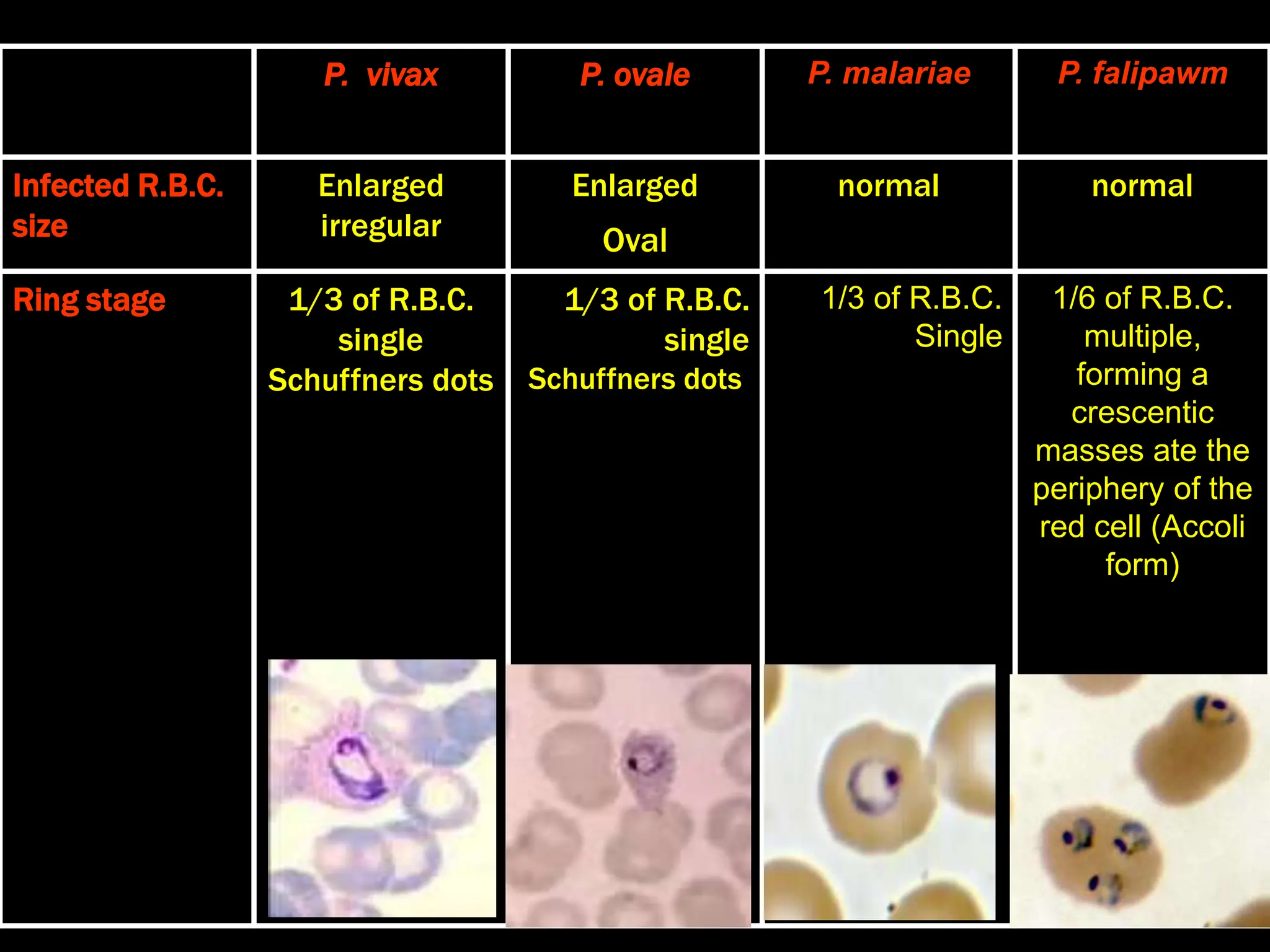 Diagnosis of malaria.ppt