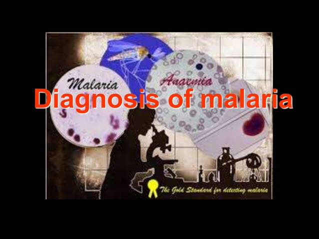 Diagnosis of malaria.ppt