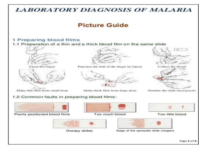 Diagnosis of malaria.ppt