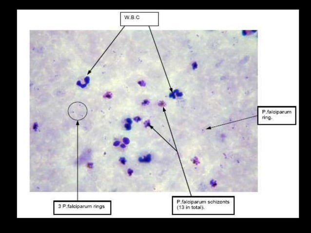 Diagnosis of malaria.ppt