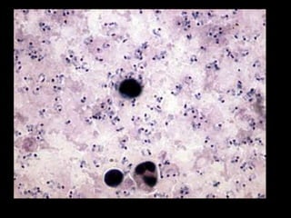 Diagnosis of malaria.ppt