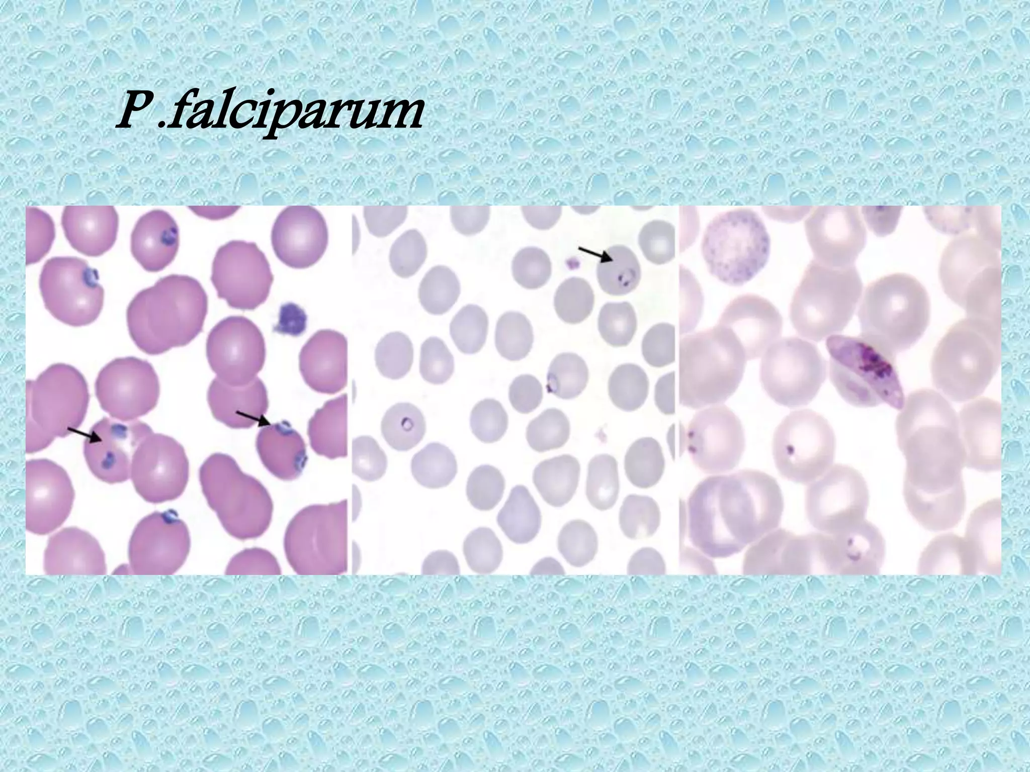 Diagnosis of four malaria parasites | PPSX