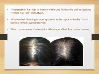 Diagnosis of pcos | PPTX