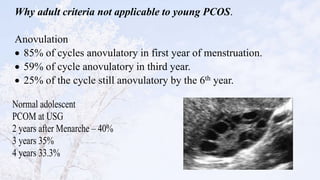 Diagnosis of PCOS MCMCTACONSESSION4.pptx