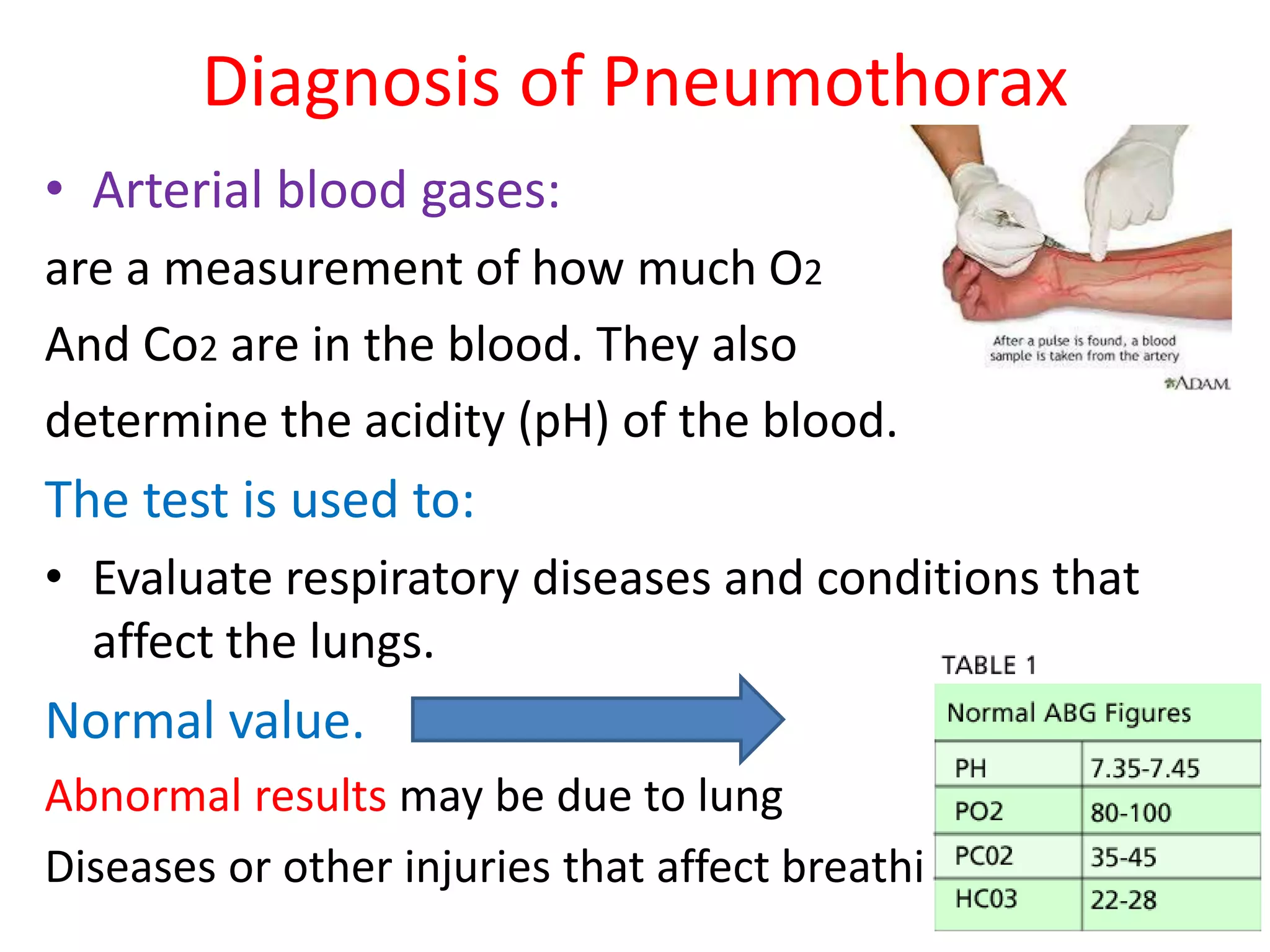 Diagnosis of pneumothorax | PPTX