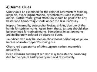 DIAGNOSIS OF POisoning -WPS Office.pptx