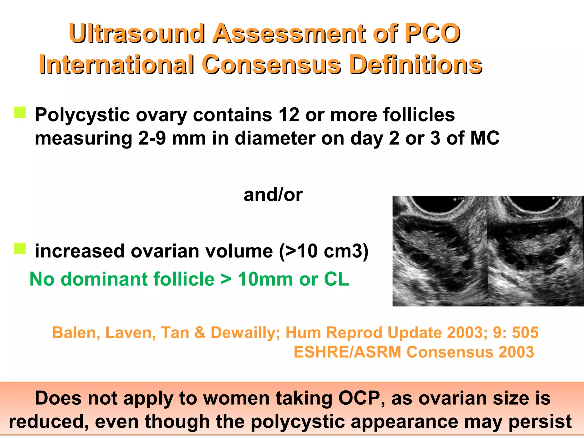 Diagnosis of polycystic ovary syndrome | PPT