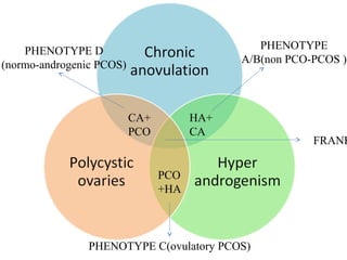 Diagnosis of polycystic ovary syndrome | PPT