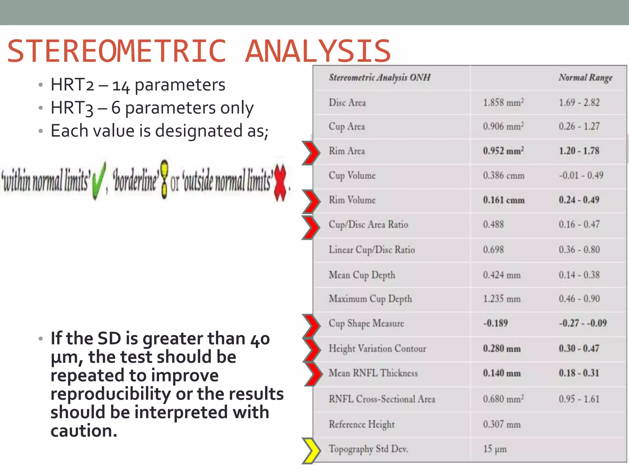 Diagnosis of pre perimetric glaucoma | PPTX
