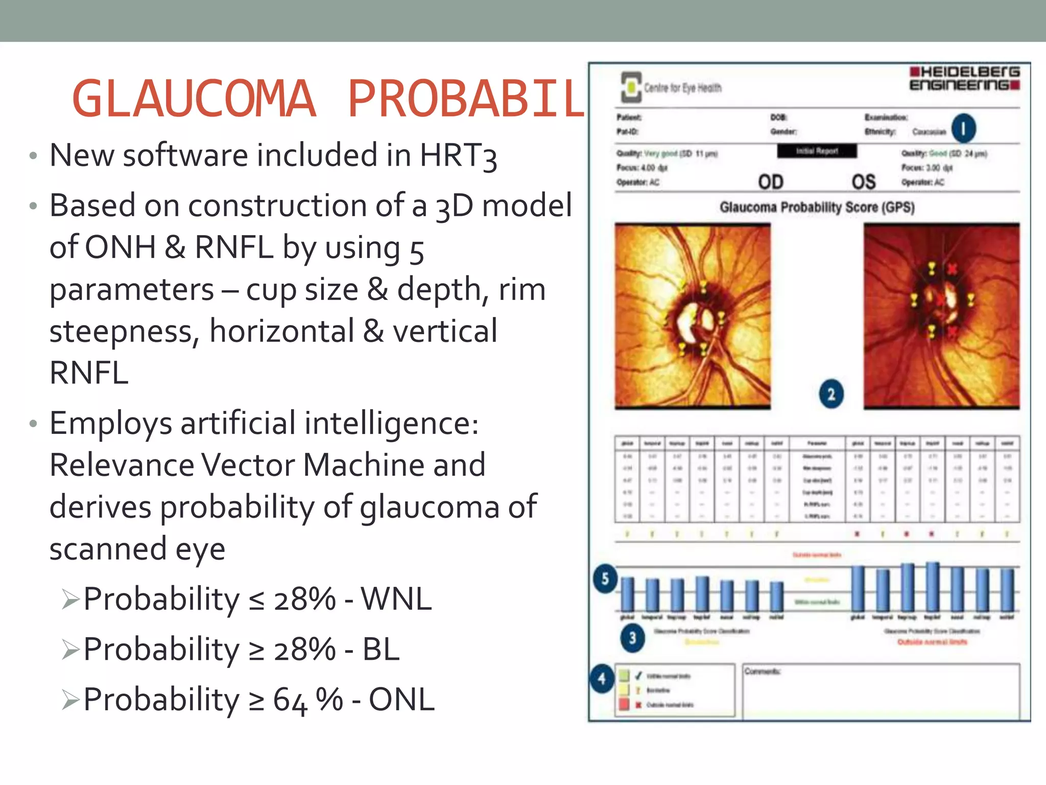 Diagnosis of pre perimetric glaucoma | PPTX
