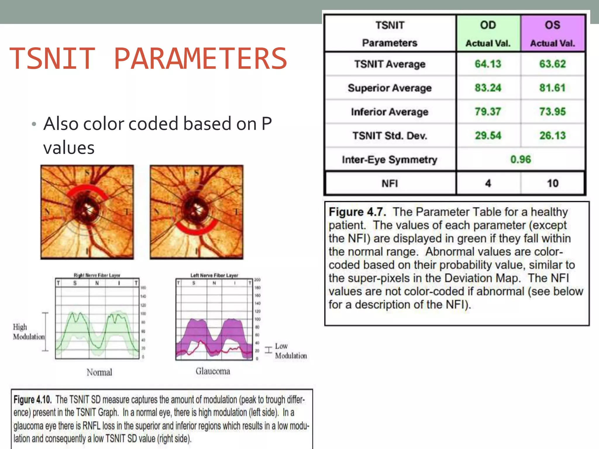 Diagnosis of pre perimetric glaucoma | PPTX