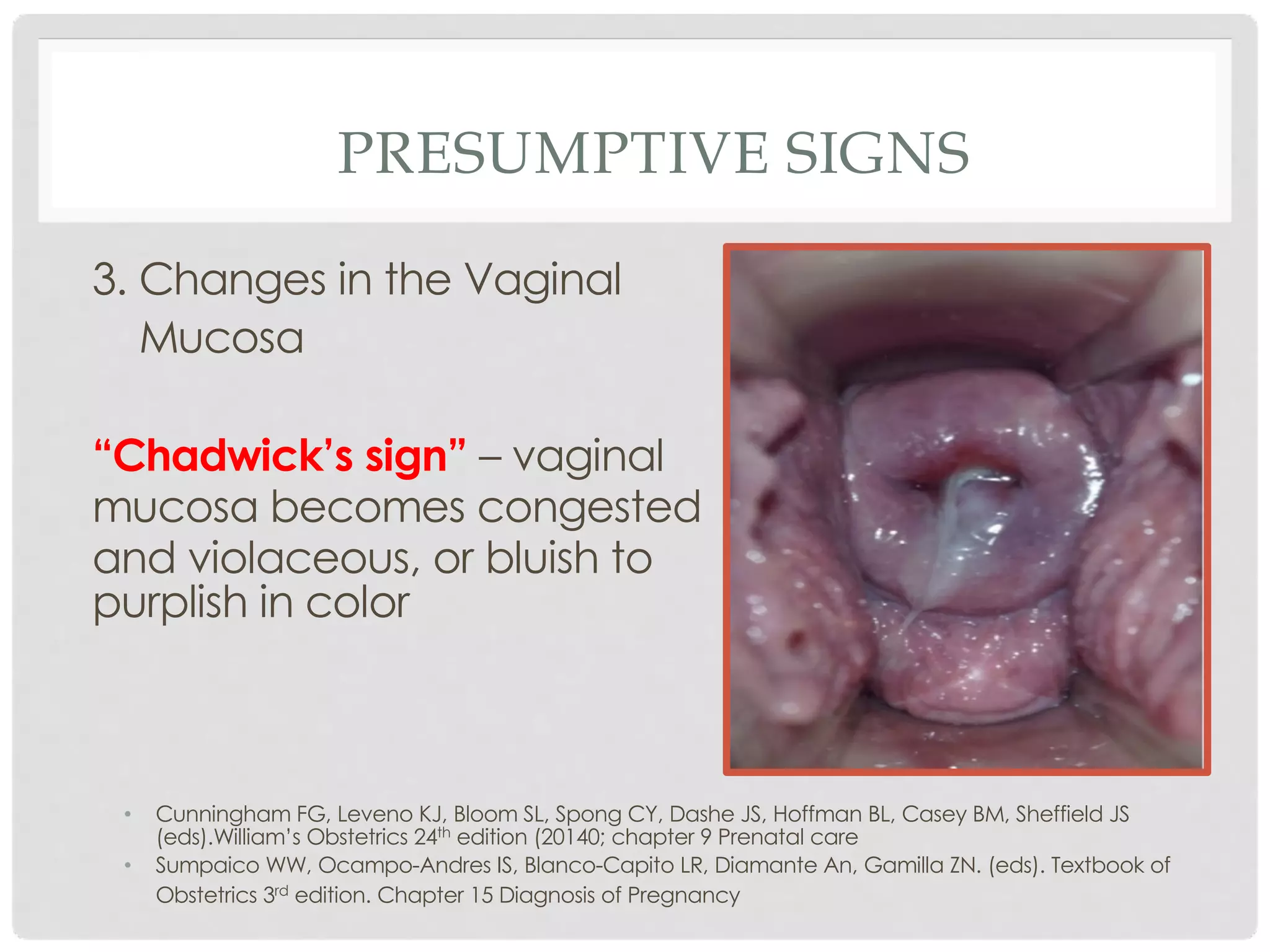 Diagnosis of pregnancy | PDF