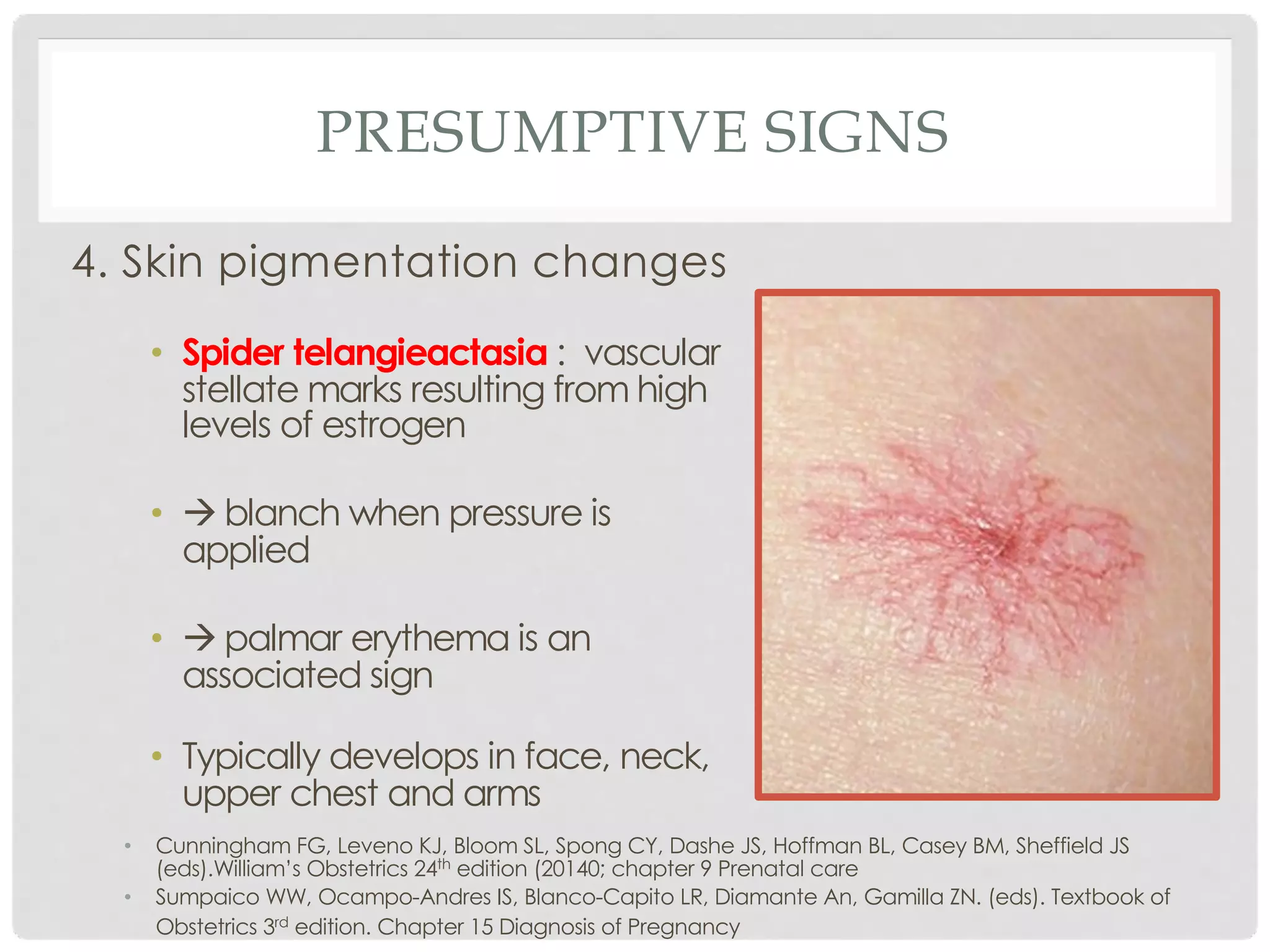 Diagnosis of pregnancy | PDF