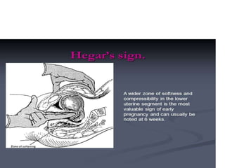 Diagnosis of pregnancy | PPT