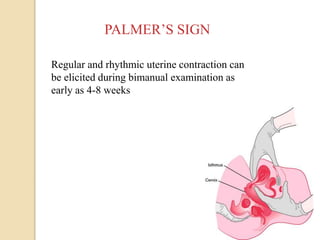 Diagnosis of pregnancy | PPTX