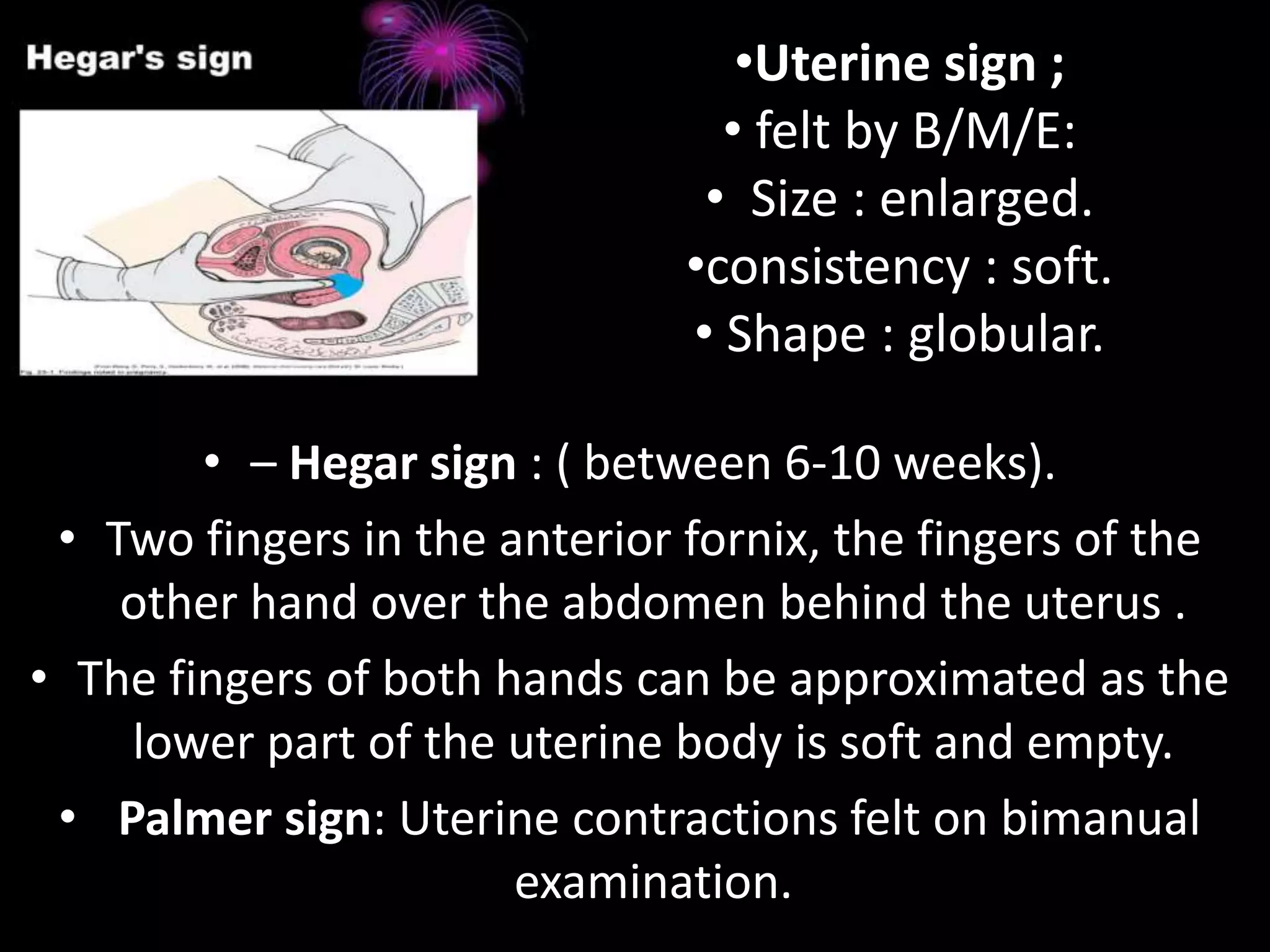 Diagnosis of pregnancy | PPT