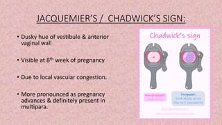 Chadwicks Sign