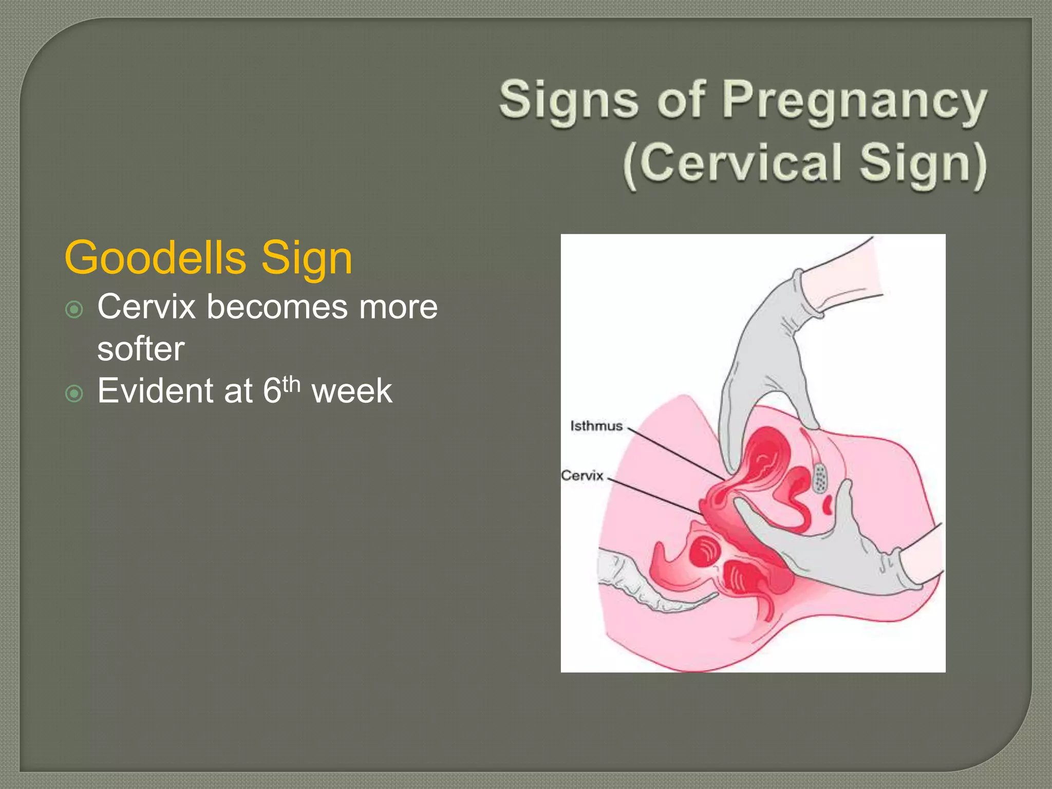 Diagnosis of pregnancy.pptx