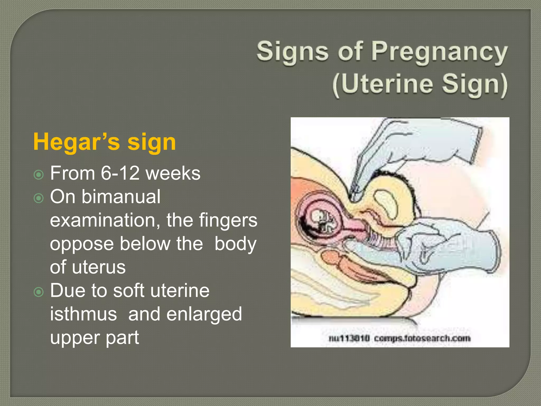 Diagnosis of pregnancy.pptx