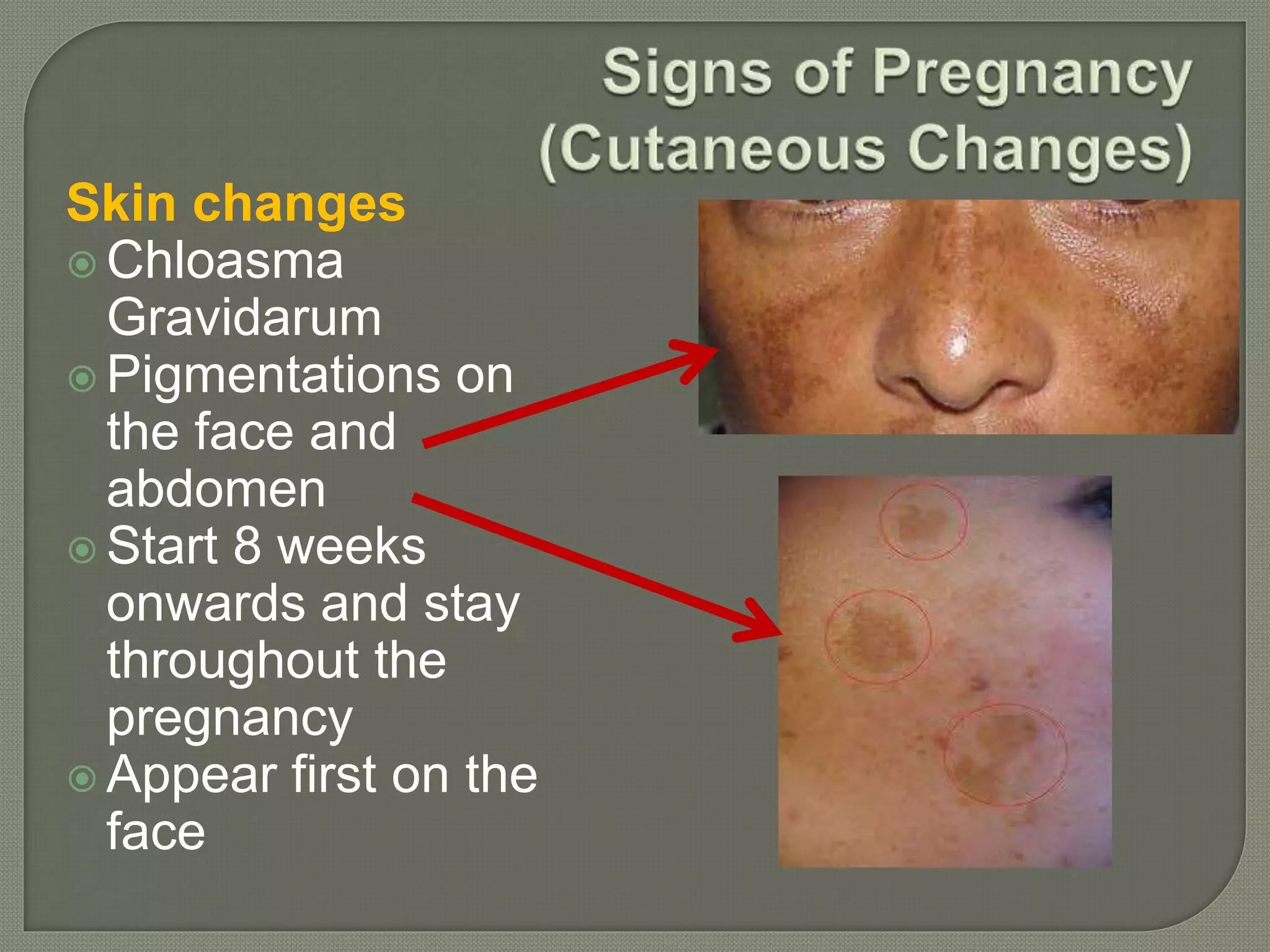 Diagnosis of pregnancy.pptx