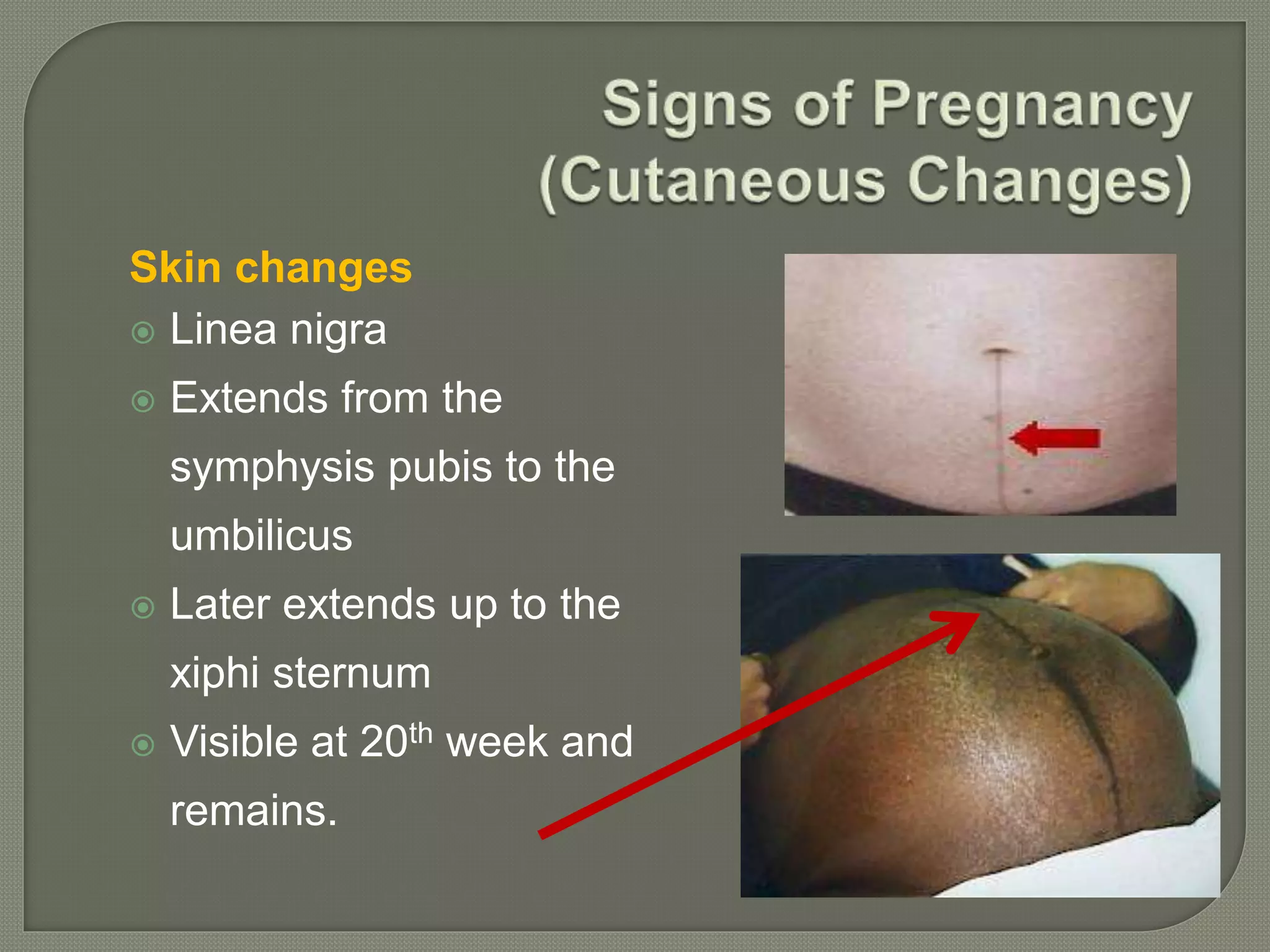 Diagnosis of pregnancy.pptx