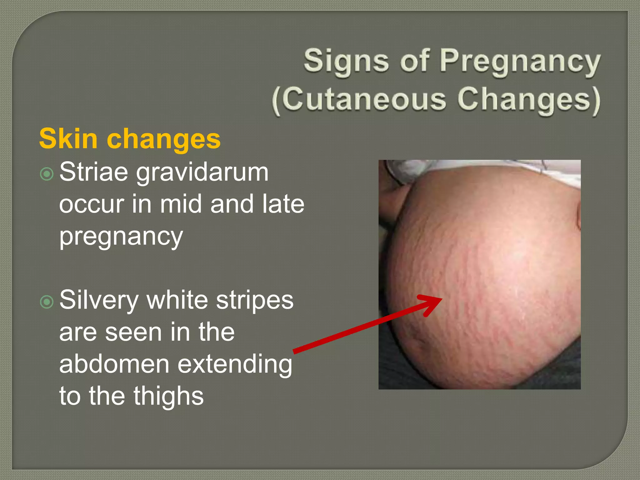 Diagnosis of pregnancy.pptx