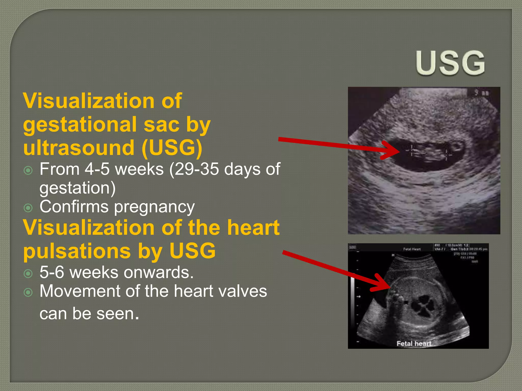 Diagnosis of pregnancy.pptx