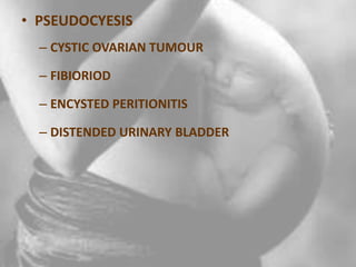 Diagnosis of pregnancy-christena | PPTX