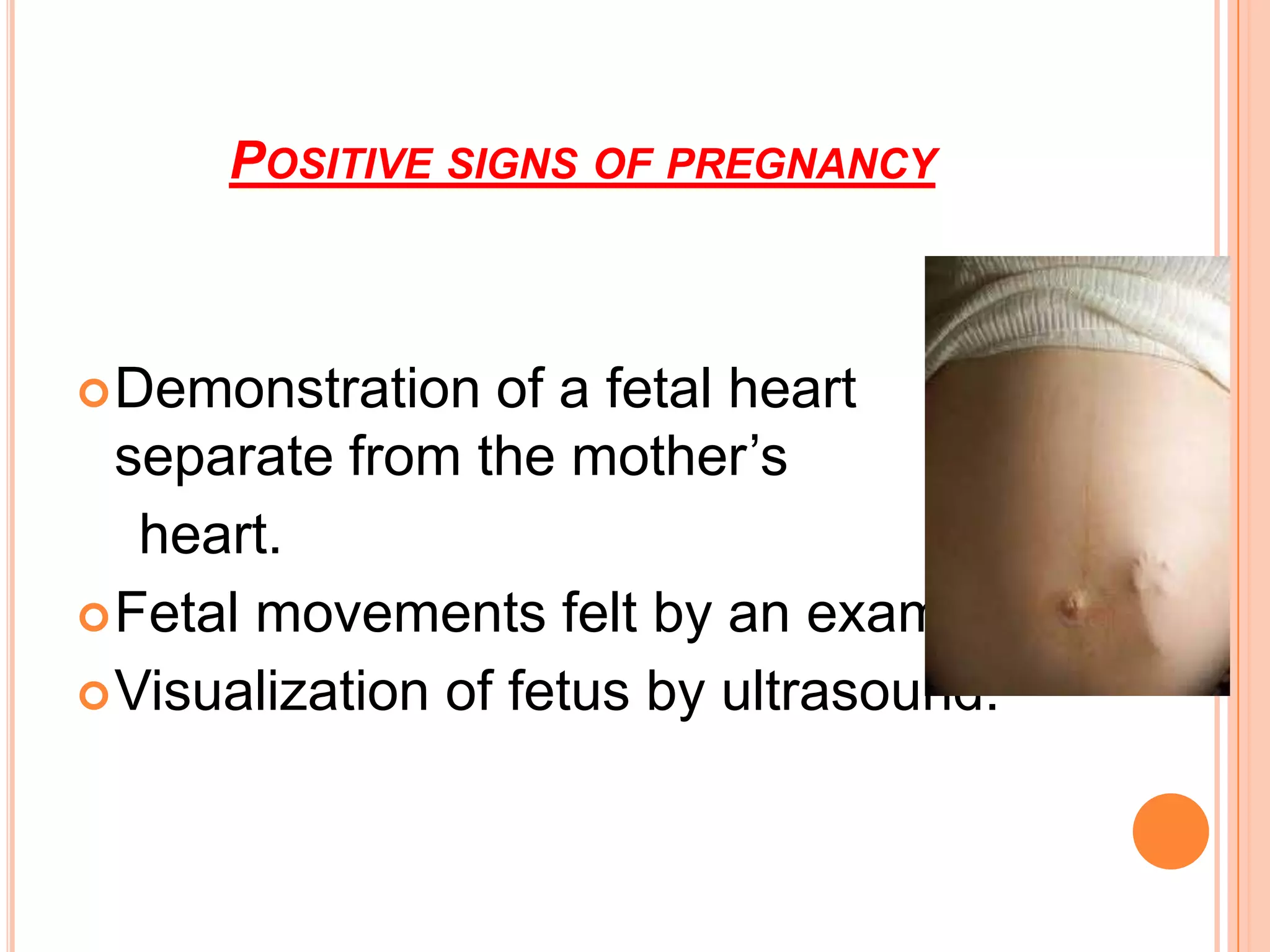 Diagnosis of pregnancy and maternal assessment | PPTX