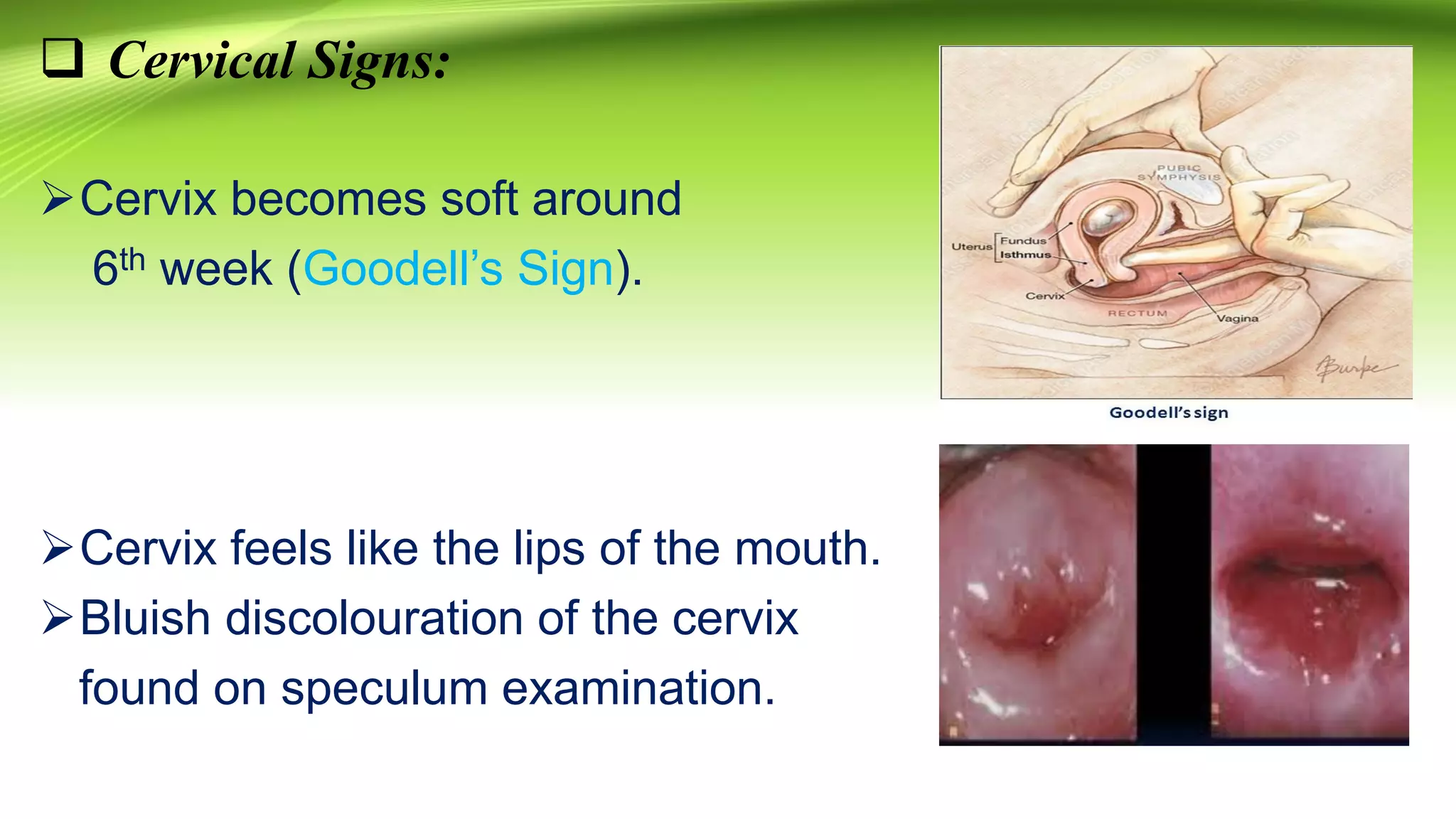 Diagnosis of Pregnancy in First Trimester | PDF