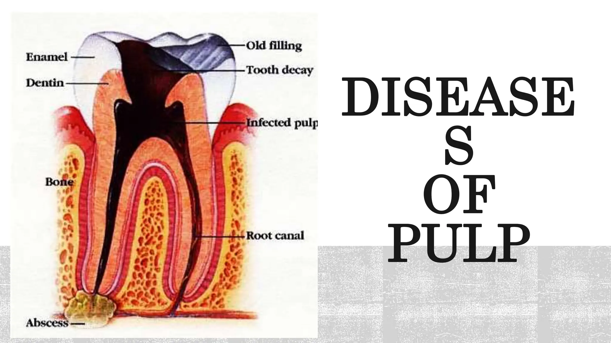 DIAGNOSIS OF PULP.pptx