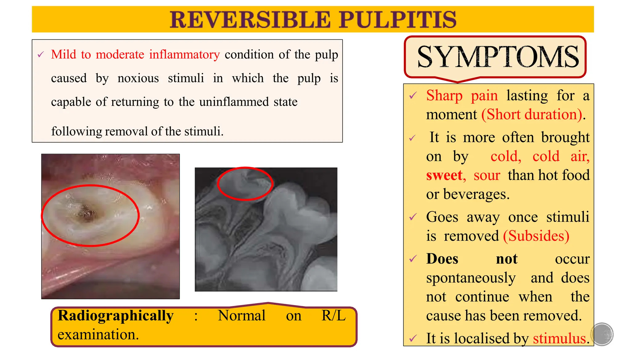 DIAGNOSIS OF PULP.pptx