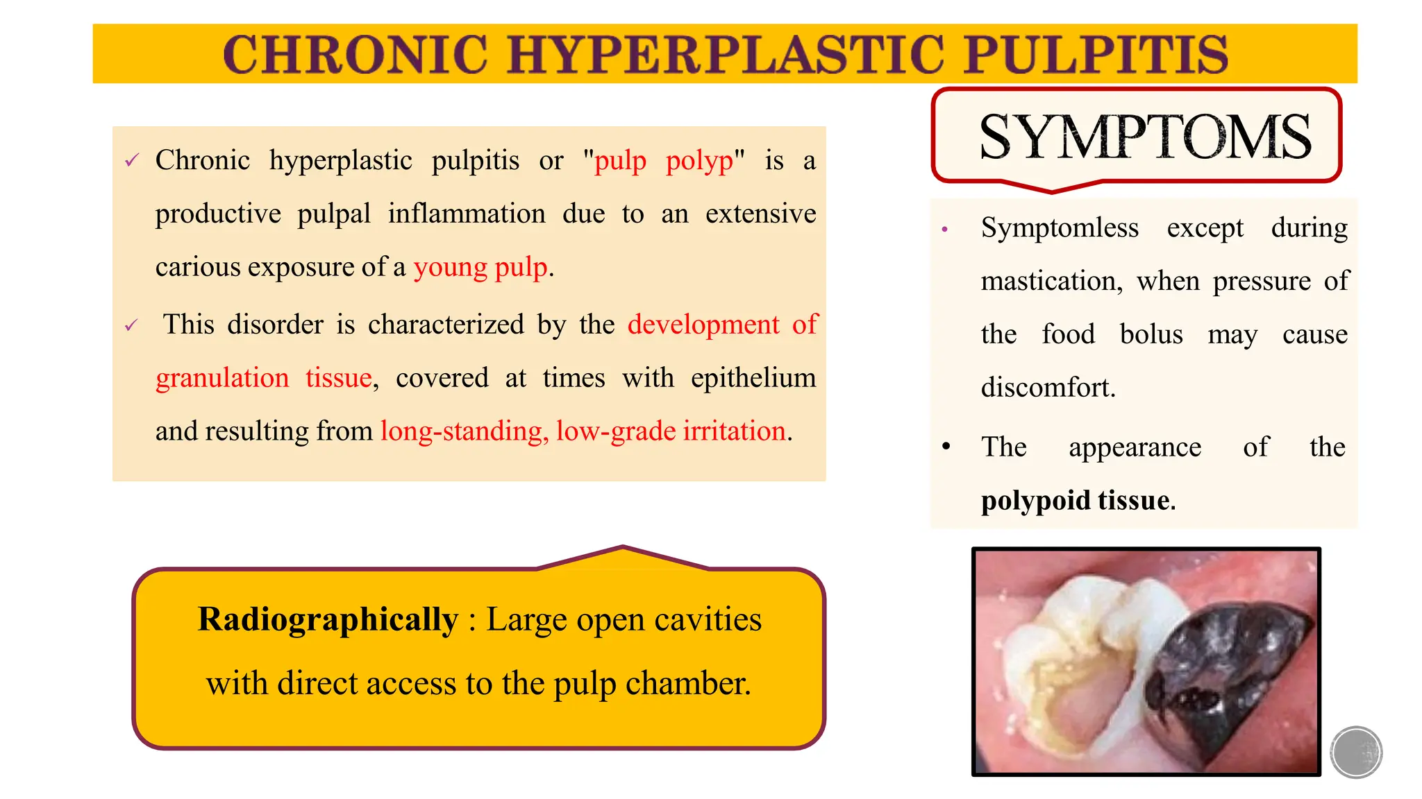DIAGNOSIS OF PULP.pptx