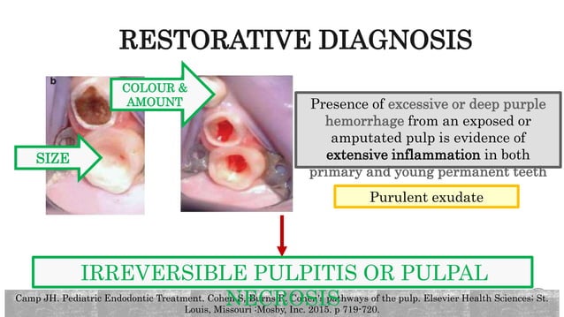 DIAGNOSIS OF PULP.pptx | Dental Health | Diseases and Conditions