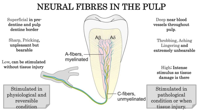 DIAGNOSIS OF PULP.pptx | Dental Health | Diseases and Conditions