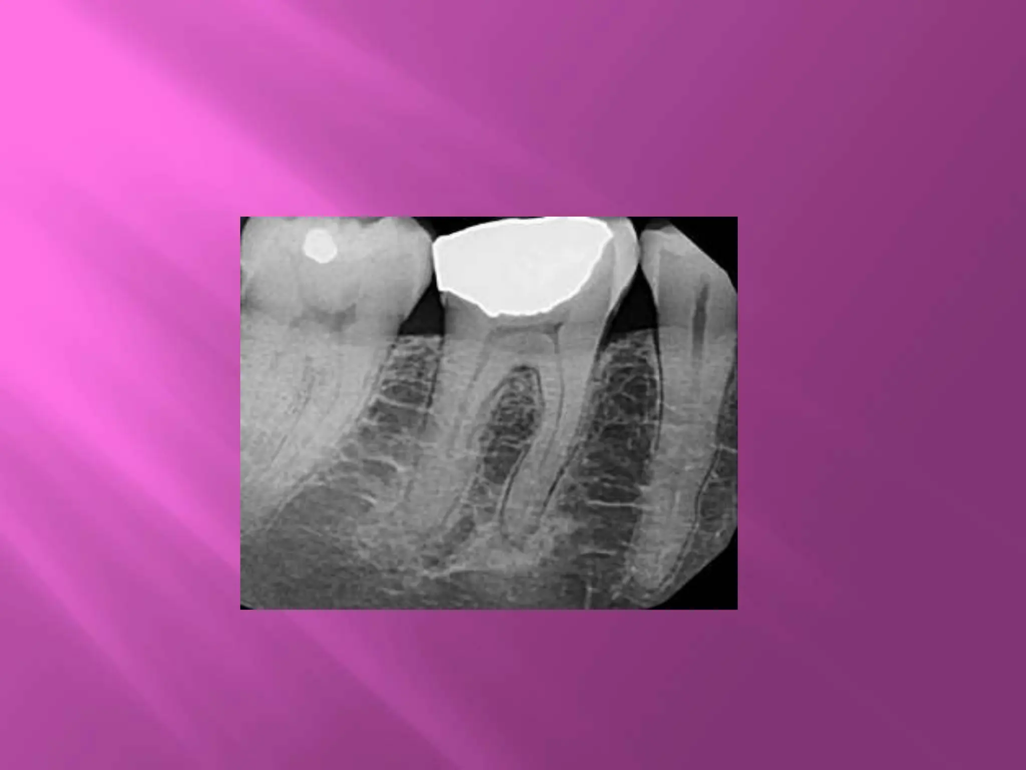 Diagnosis of pulpal diseases. Satti.pptx