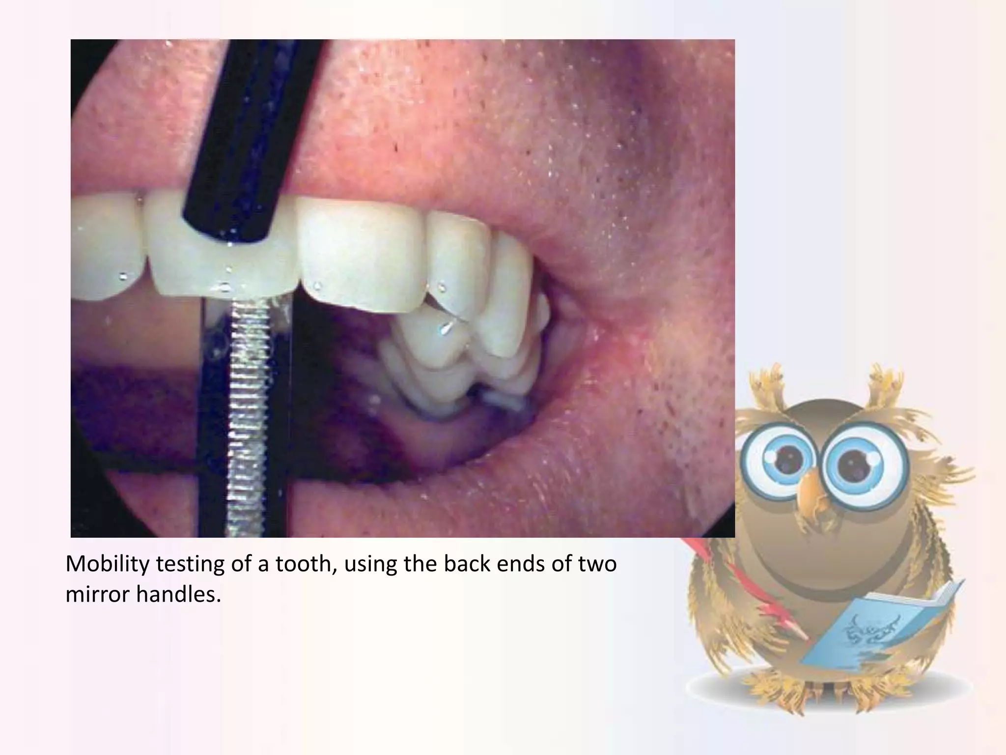 Diagnosis of pulpal pathology ( Abdullah karamat ) | PPTX