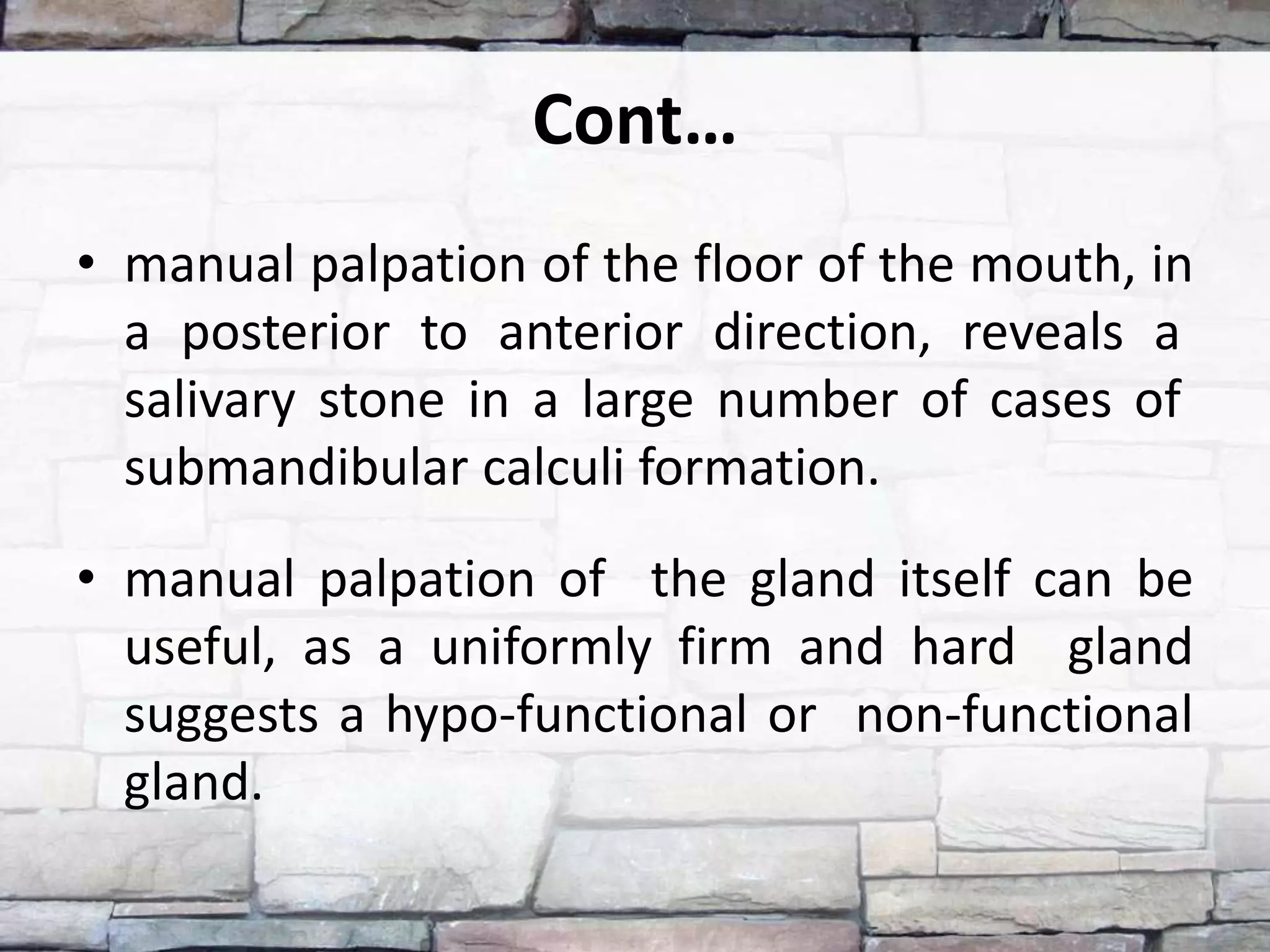 Diagnosis of salivary stones | PPTX