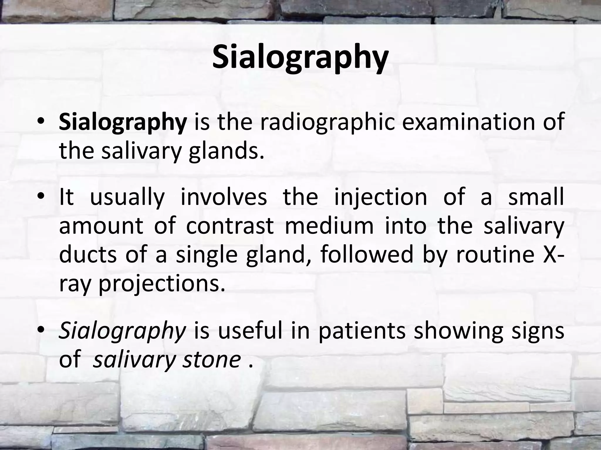 Diagnosis of salivary stones | PPTX