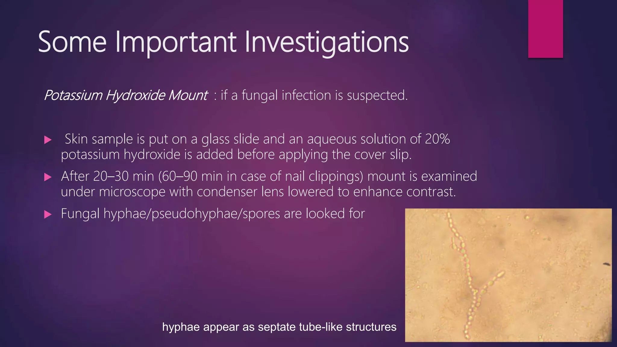 Diagnosis of skin disease | PPTX