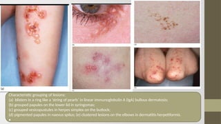 diagnosis of skin diseases description.pptx