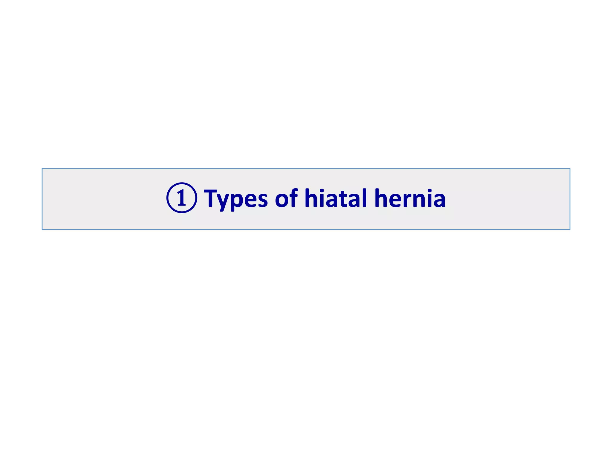Diagnosis of sliding hiatal hernia | PPTX