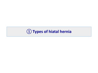 Diagnosis of sliding hiatal hernia | PPTX