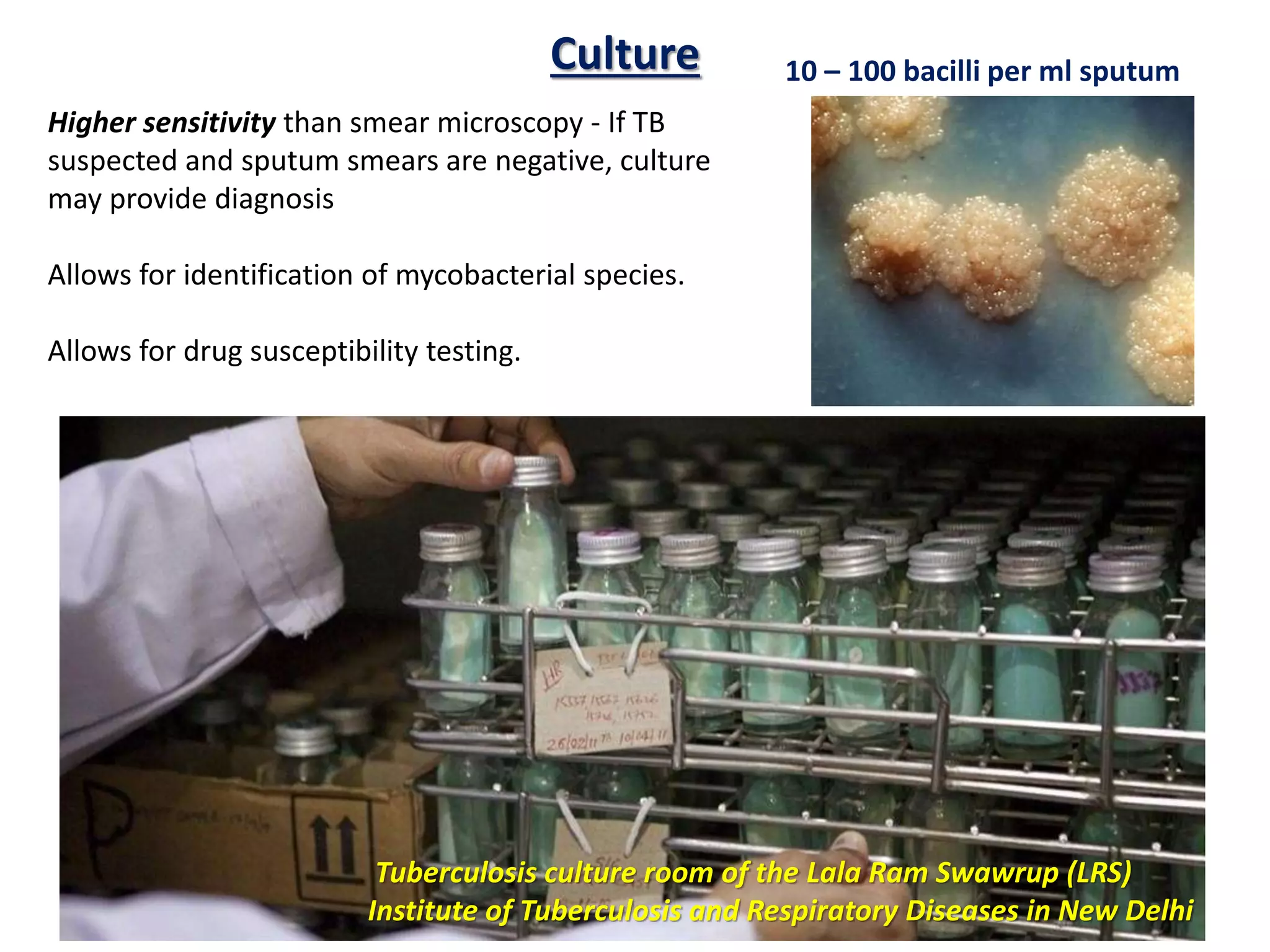 Diagnosis of Tuberculosis | PPTX